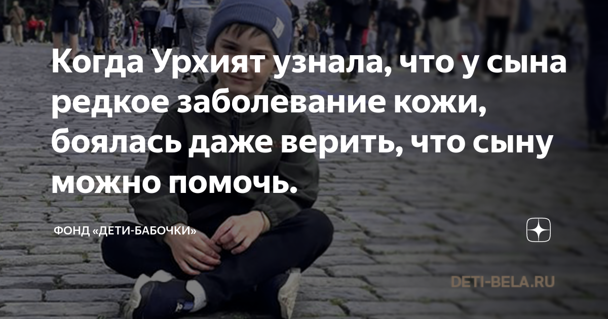 Когда Урхият узнала что у сына редкое заболевание кожи боялась даже верить что сыну можно