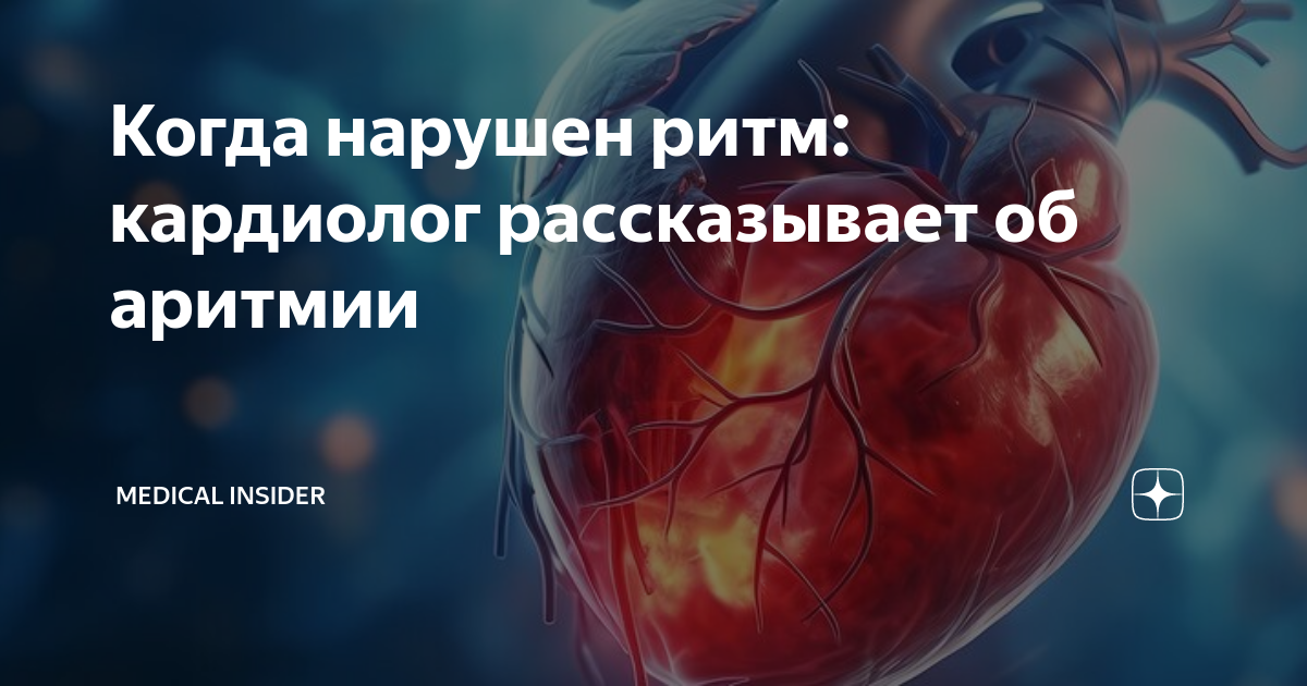 Когда нарушен ритм: кардиолог рассказывает об аритмии | Мedical Insider | Дзен