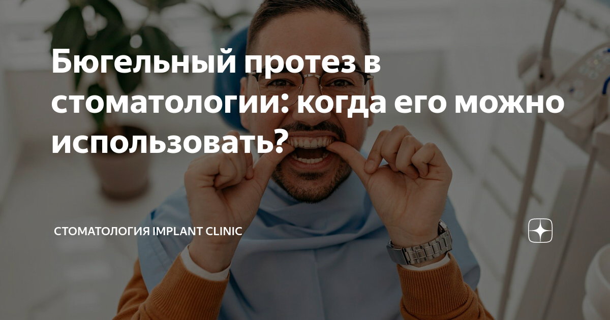 Бюгельный протез в стоматологии: когда его можно использовать ...