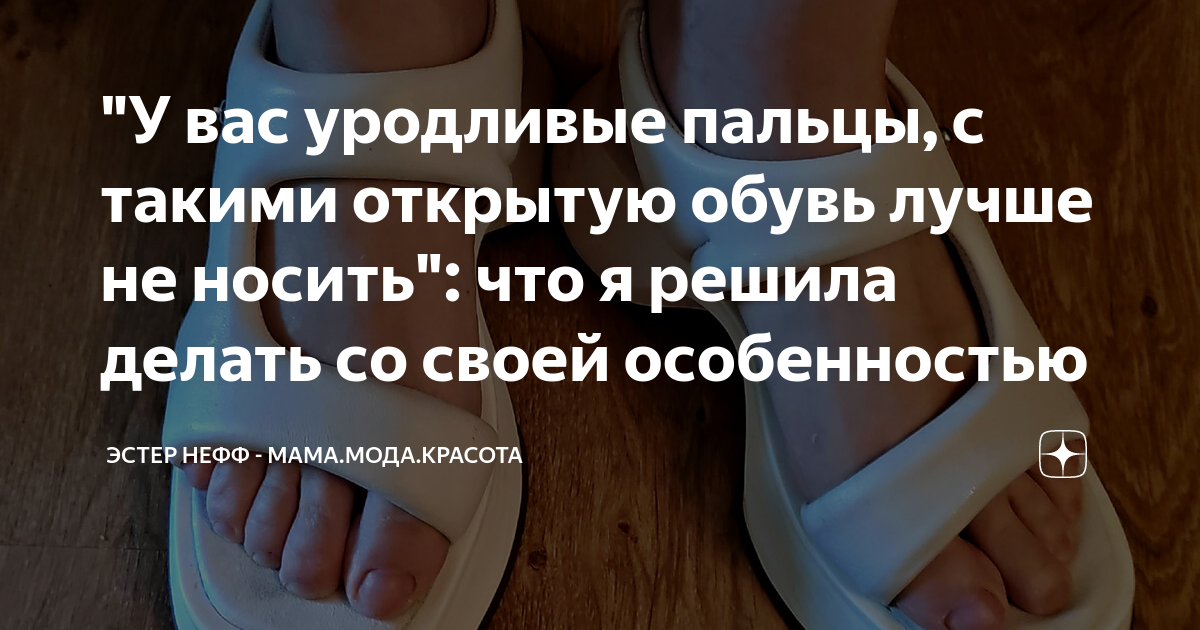 "У вас уродливые пальцы, с такими открытую обувь лучше не носить": что ...