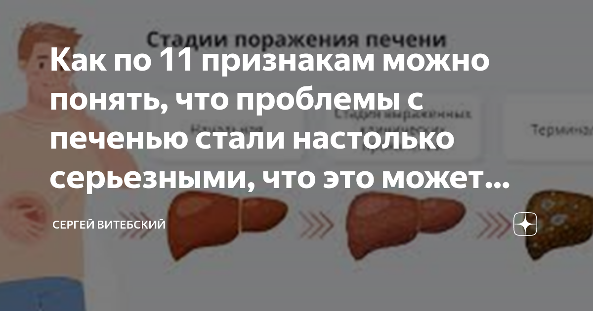 Как по 11 признакам можно понять что проблемы с печенью стали настолько серьезными что это