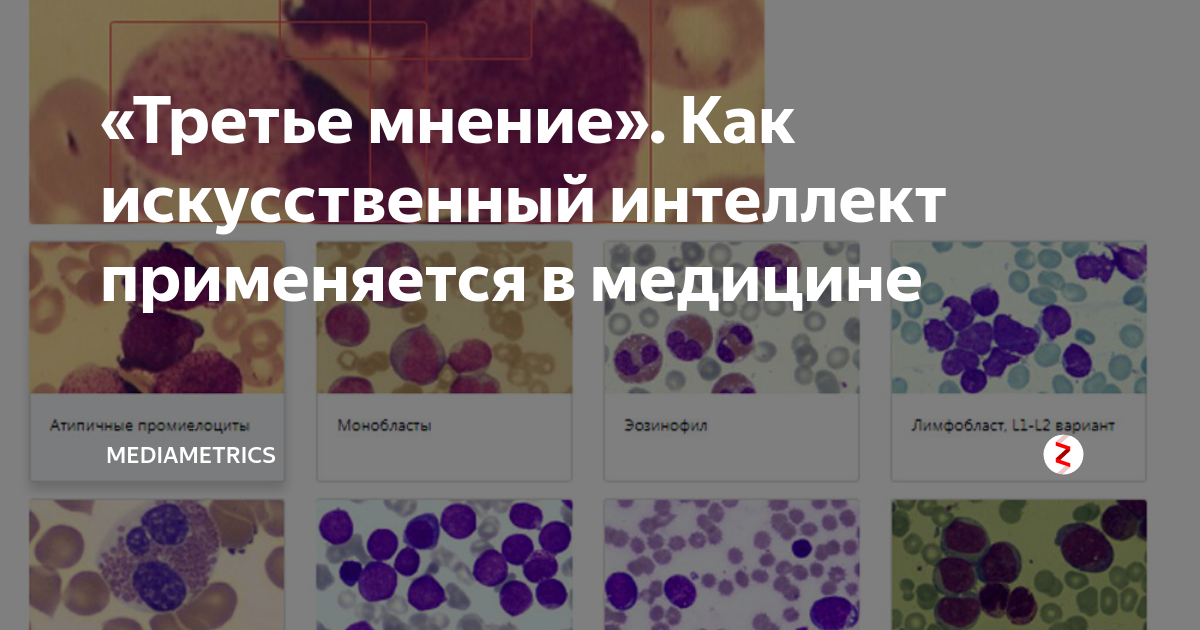 «Третье мнение Как искусственный интеллект применяется в медицине