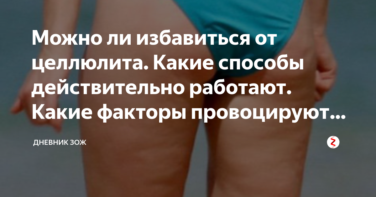 Можно ли избавиться от целлюлита. Какие способы действительно работают ...