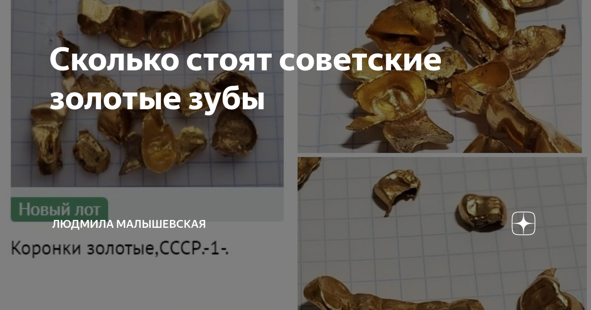 Сколько стоят советские золотые зубы | Людмила Малышевская | Дзен