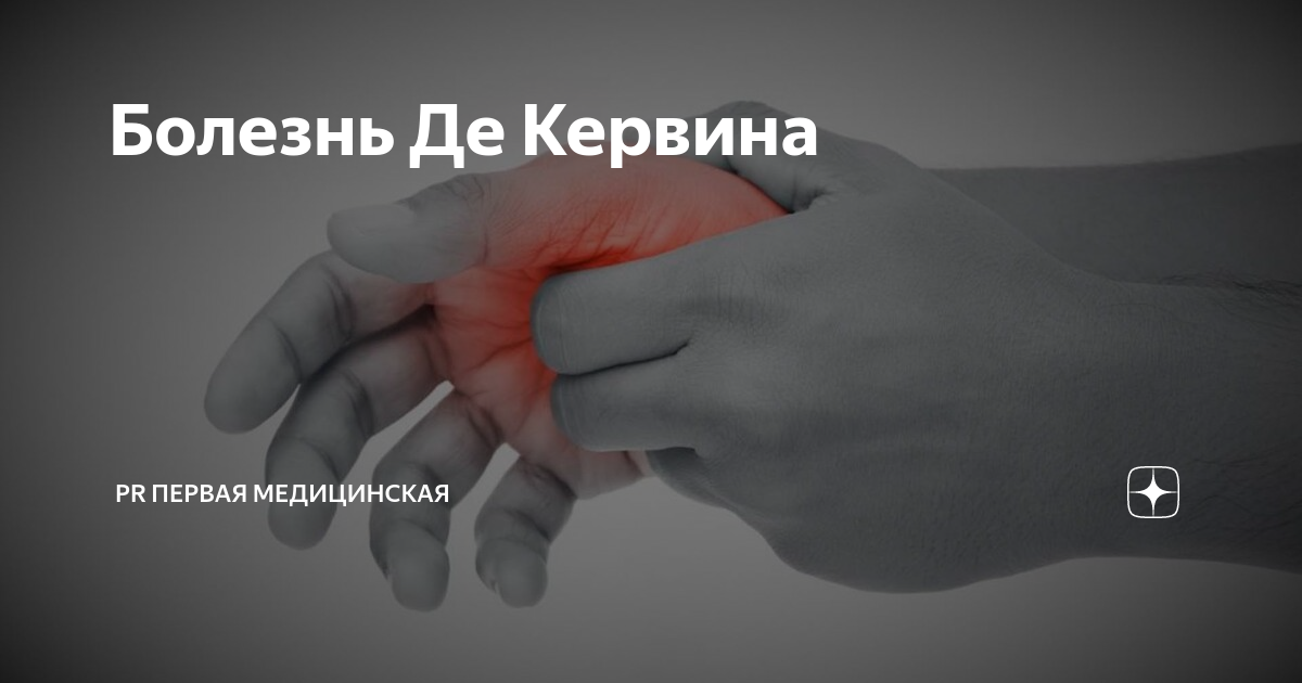 Болезнь Де Кервина Первая Медицинская Клиника Дзен