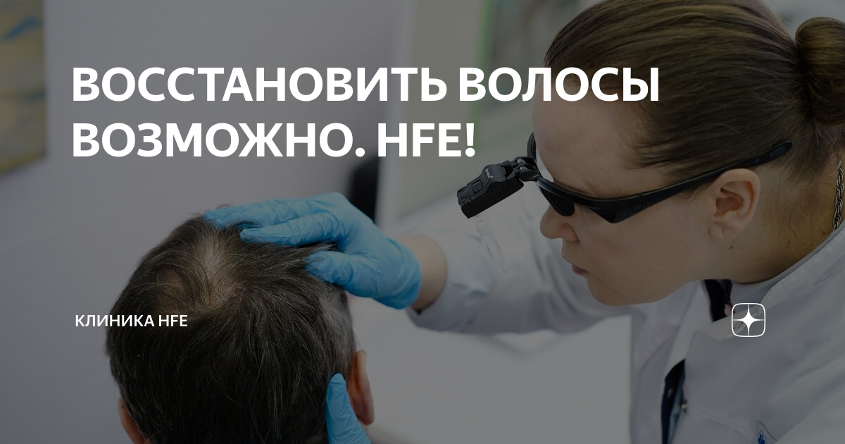 ВОССТАНОВИТЬ ВОЛОСЫ ВОЗМОЖНО. HFE! | Клиника HFE | Дзен