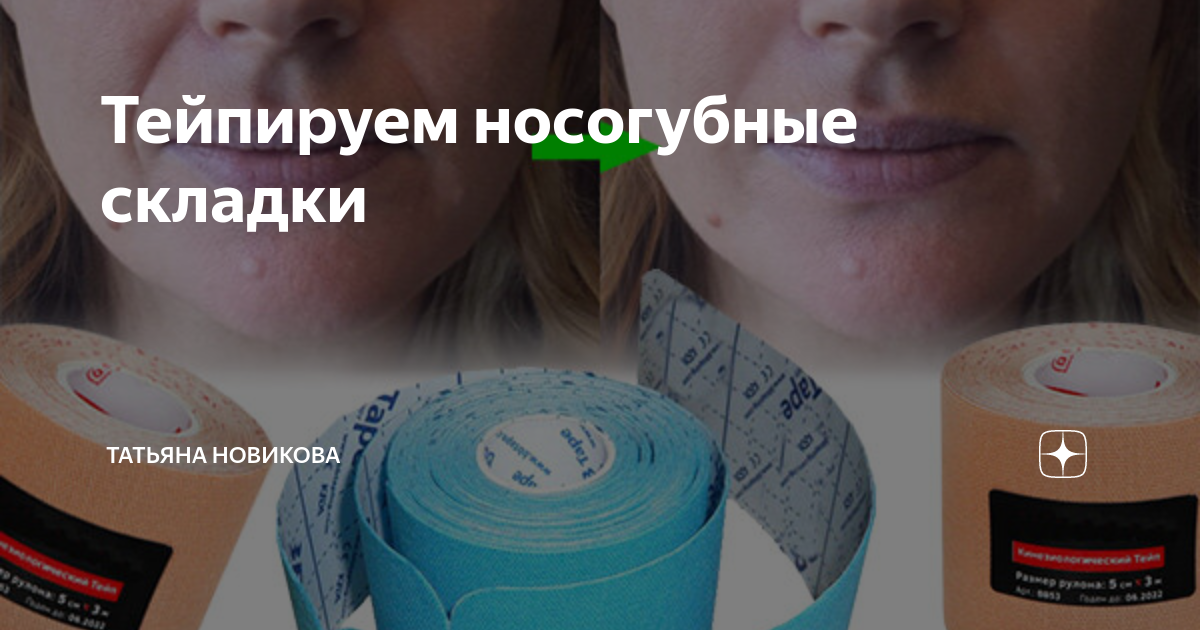 Тейпируем носогубные складки | Татьяна Новикова | Дзен