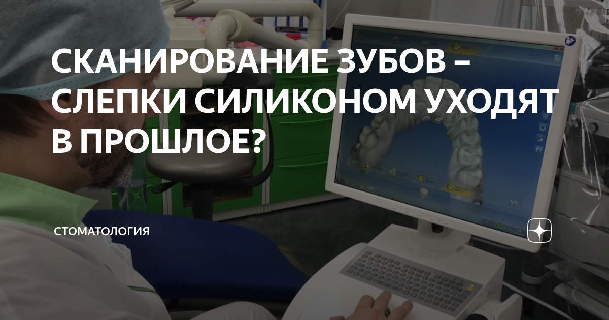 СКАНИРОВАНИЕ ЗУБОВ – СЛЕПКИ СИЛИКОНОМ УХОДЯТ В ПРОШЛОЕ? | Стоматология ...