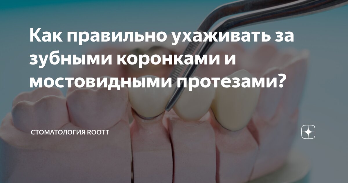 Как правильно ухаживать за зубными коронками и мостовидными протезами Стоматология Roott Дзен