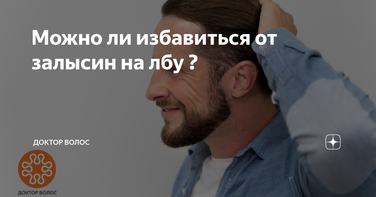 Можно ли избавиться от залысин на лбу ? | Доктор Волос | Дзен