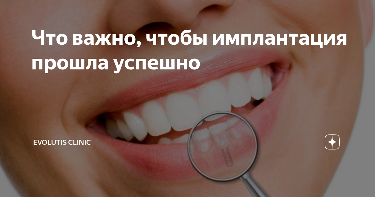 Что важно, чтобы имплантация прошла успешно | Evolutis Clinic | Дзен