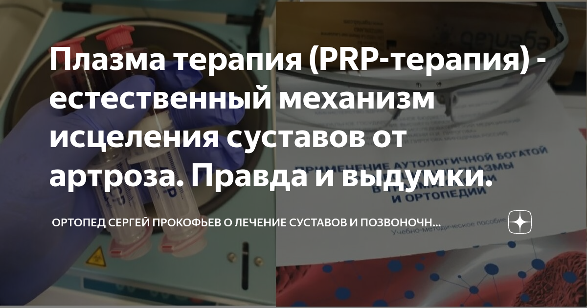 Плазма терапия (PRP-терапия) - естественный механизм исцеления суставов ...