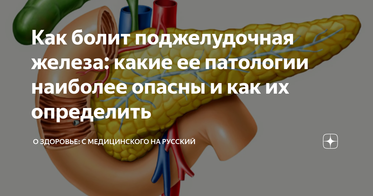 Как болит поджелудочная железа: какие ее патологии наиболее опасны и ...