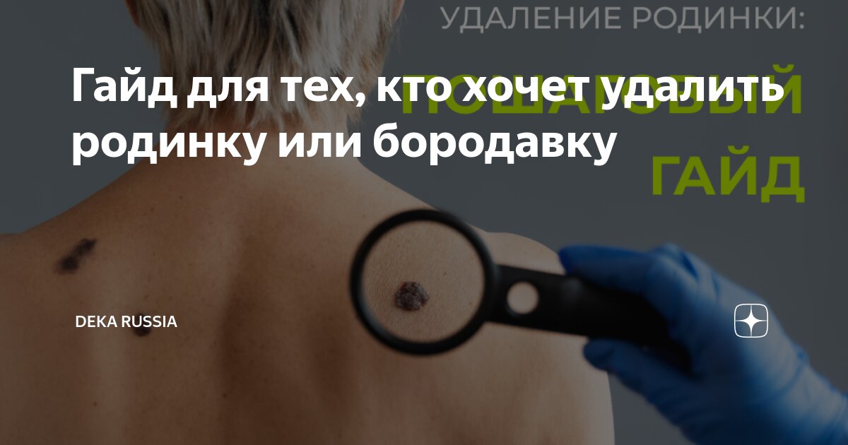 Гайд для тех, кто хочет удалить родинку или бородавку | DEKA RUSSIA | Дзен
