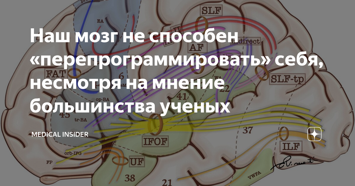 Наш мозг не способен «перепрограммировать» себя, несмотря на мнение ...