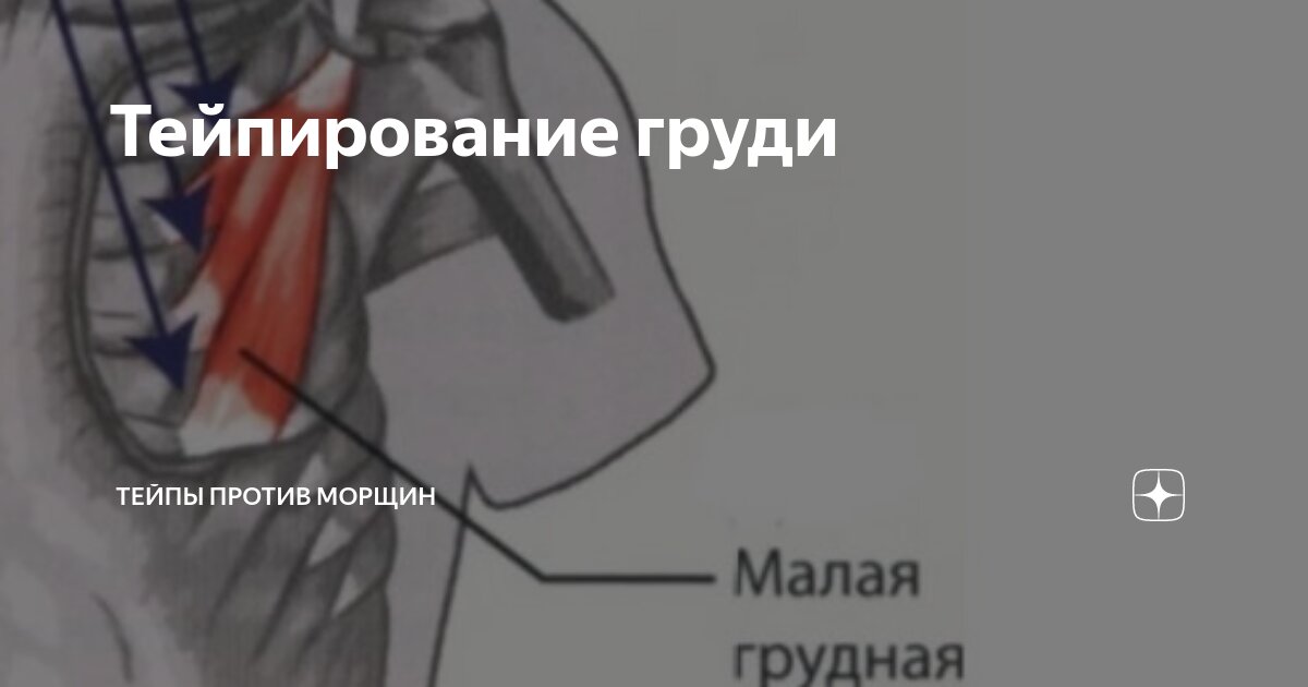 Тейпирование груди | Тейпы против морщин | Дзен