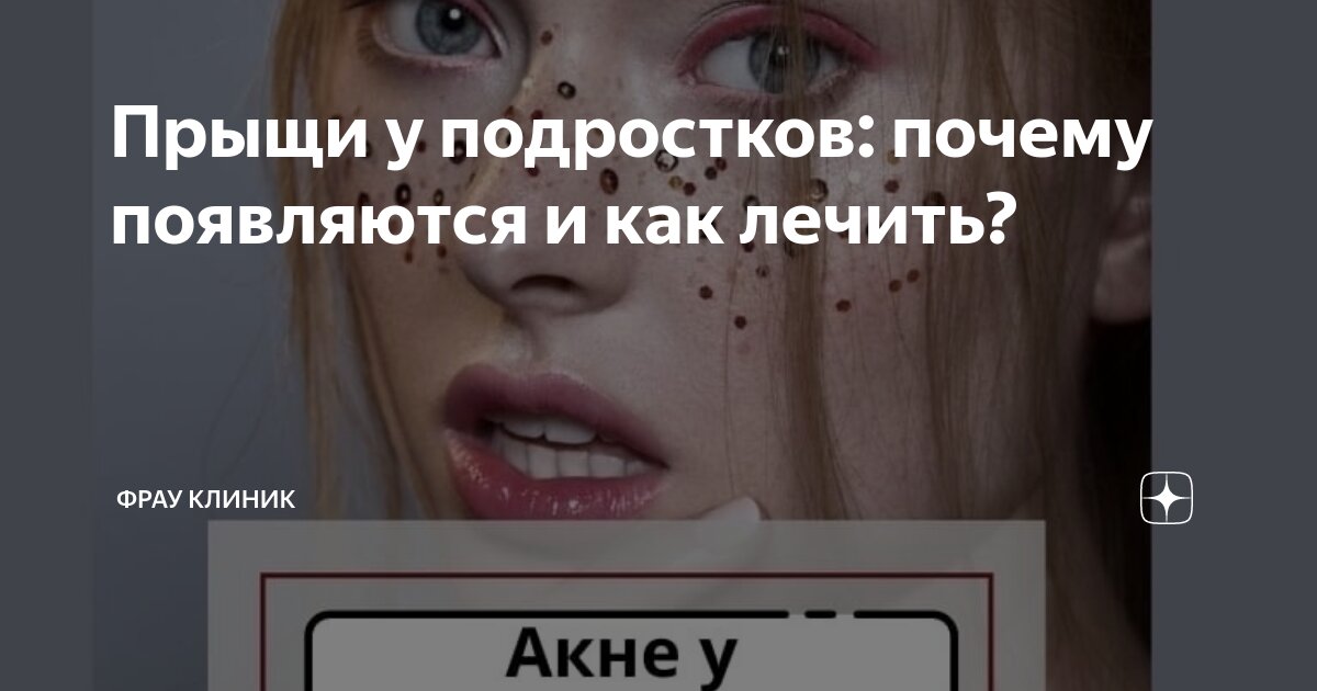 Прыщи у подростков почему появляются и как лечить Фрау Клиник Дзен
