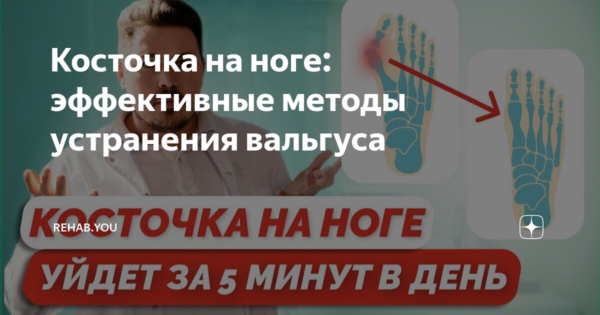Косточка на ноге эффективные методы устранения вальгуса Rehab You Дзен