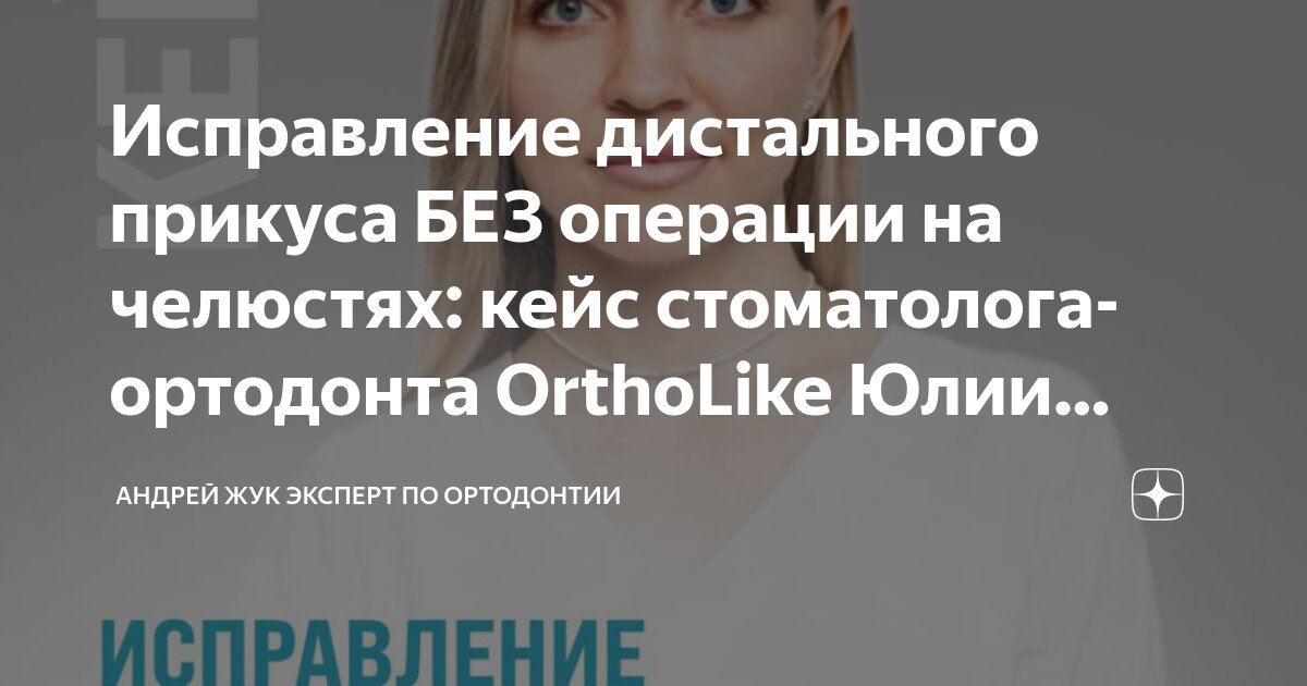 Исправление дистального прикуса БЕЗ операции на челюстях: кейс стоматолога-ортодонта OrthoLike ...