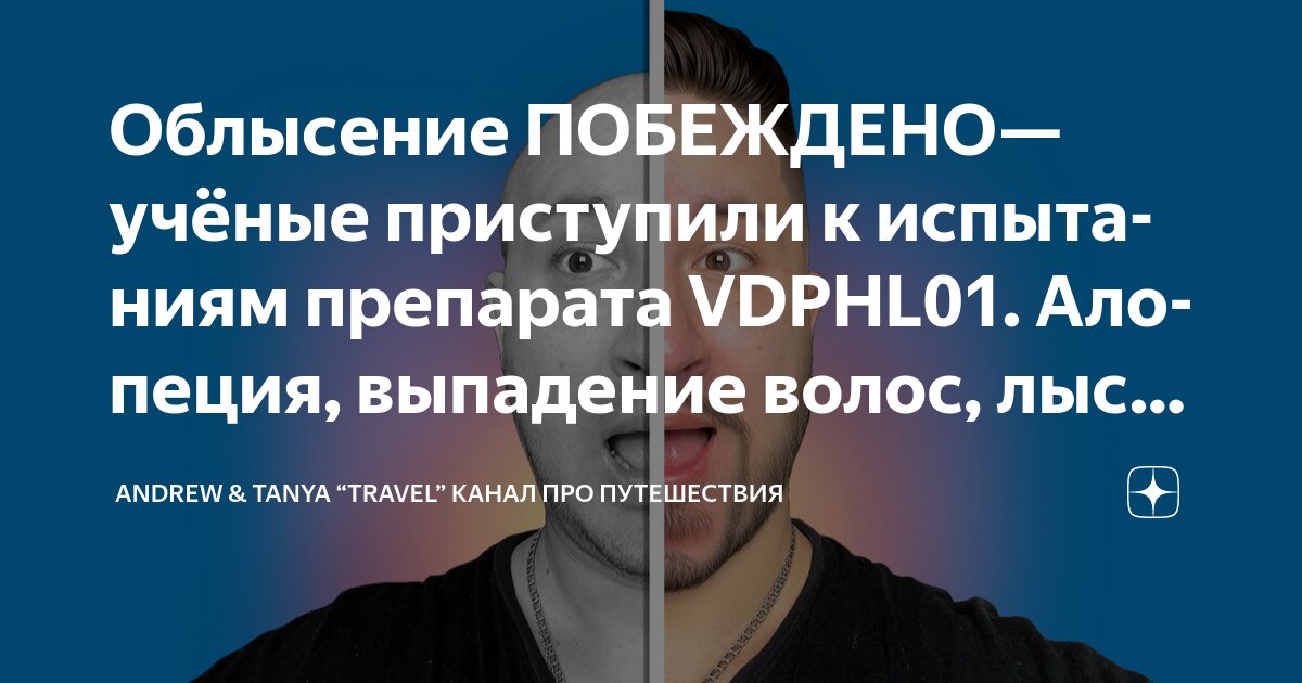 Облысение ПОБЕЖДЕНО— учёные приступили к испытаниям препарата VDPHL01 ...