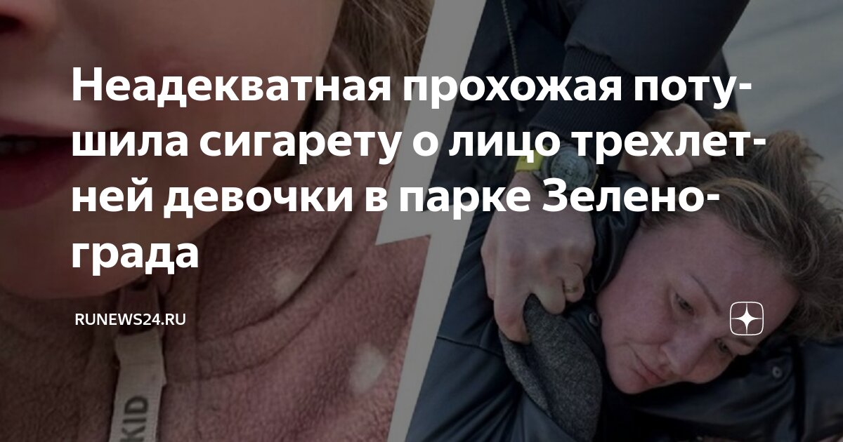 Неадекватная прохожая потушила сигарету о лицо трехлетней девочки в парке Зеленограда | RuNews24 ...