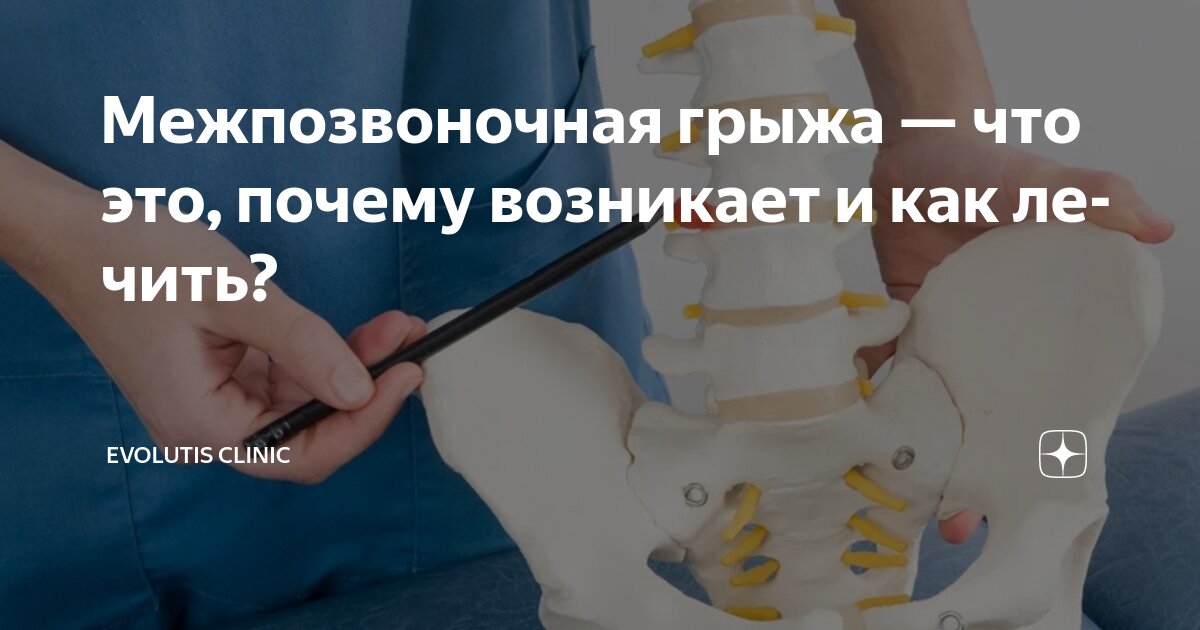 Межпозвоночная грыжа — что это почему возникает и как лечить Evolutis Clinic Дзен