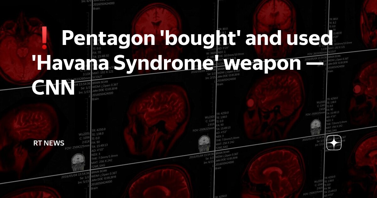 ️ Pentagon 'bought' and used 'Havana Syndrome' weapon — CNN | RT news ...