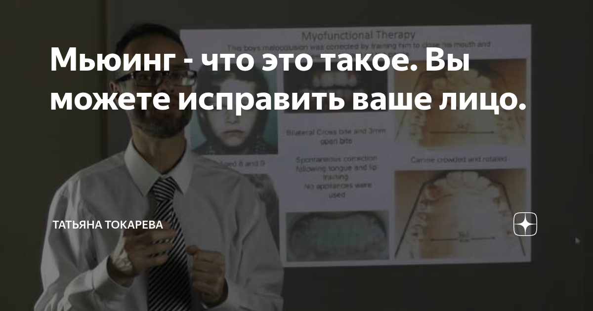 Мьюинг - что это такое. Вы можете исправить ваше лицо. | Татьяна ...