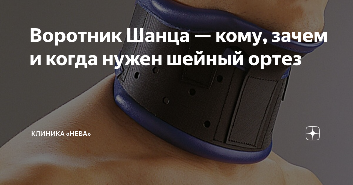 Воротник Шанца — кому зачем и когда нужен шейный ортез Клиника «Нева Дзен