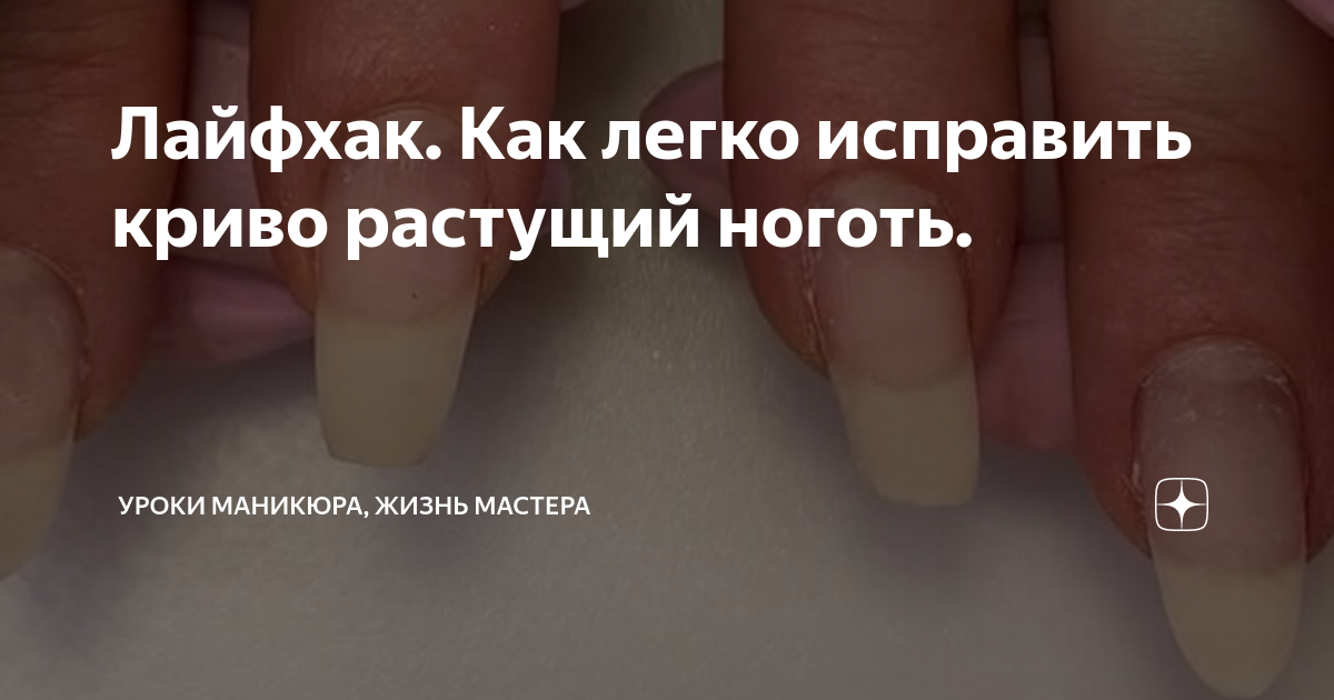 Лайфхак Как легко исправить криво растущий ноготь Уроки маникюра