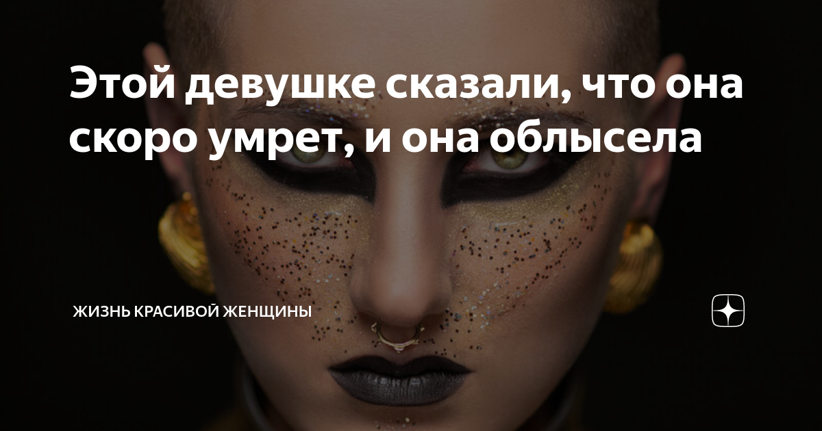 Этой девушке сказали что она скоро умрет и она облысела Жизнь