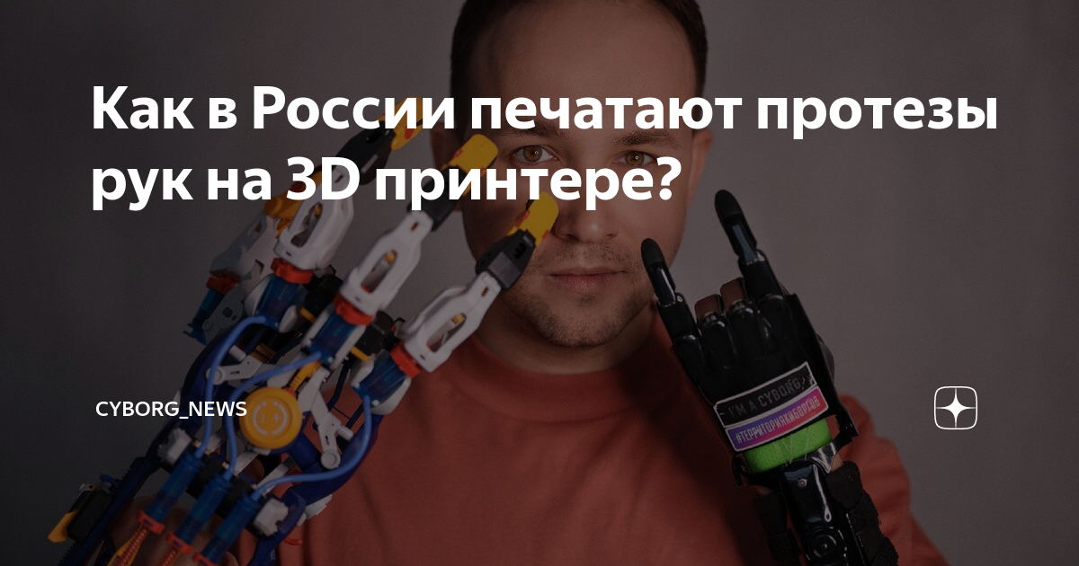 Как в России печатают протезы рук на 3d принтере Cyborg M Дзен