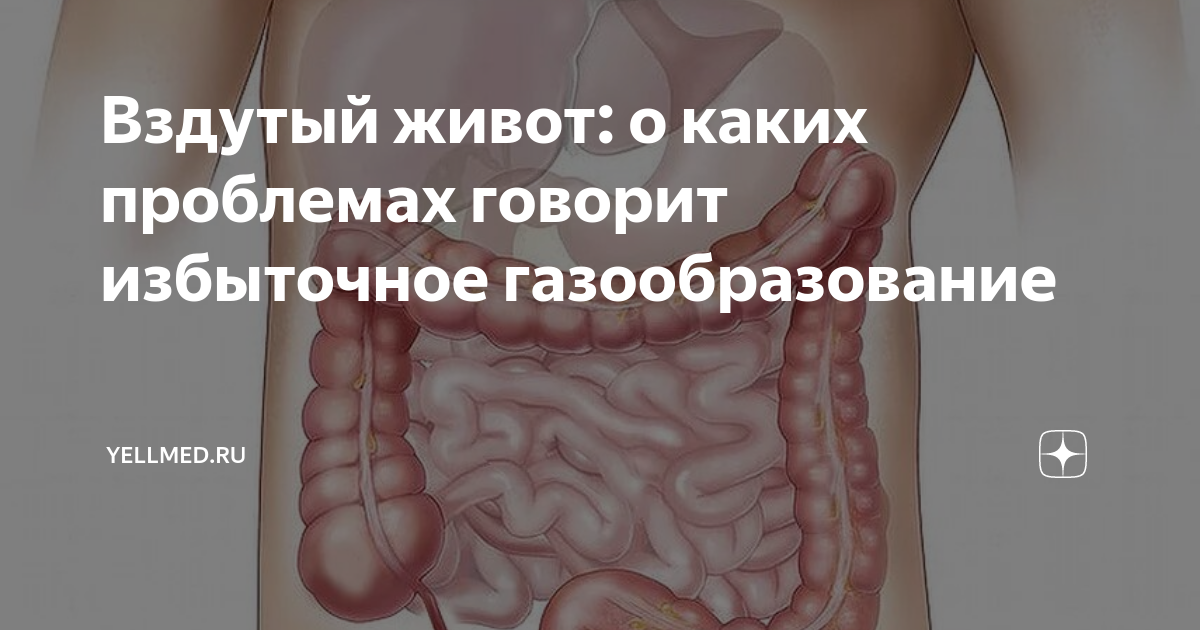 Вздутый живот: о каких проблемах говорит избыточное газообразование ...