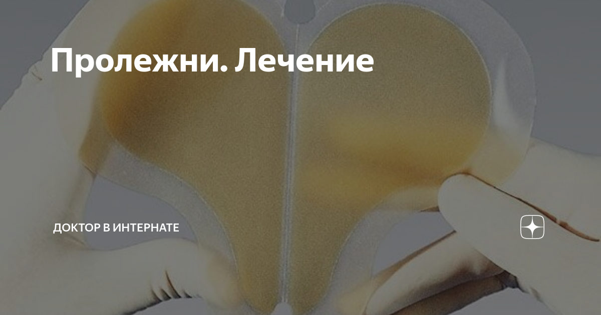 Пролежни. Лечение | Доктор о разном. Чудеса там, где в них верят | Дзен