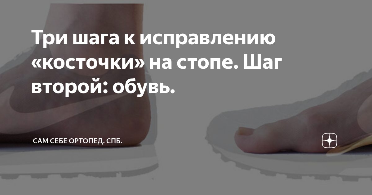 Три шага к исправлению «косточки на стопе Шаг второй обувь Сам