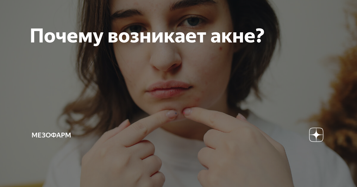Почему возникает акне? | Мезофарм | Дзен