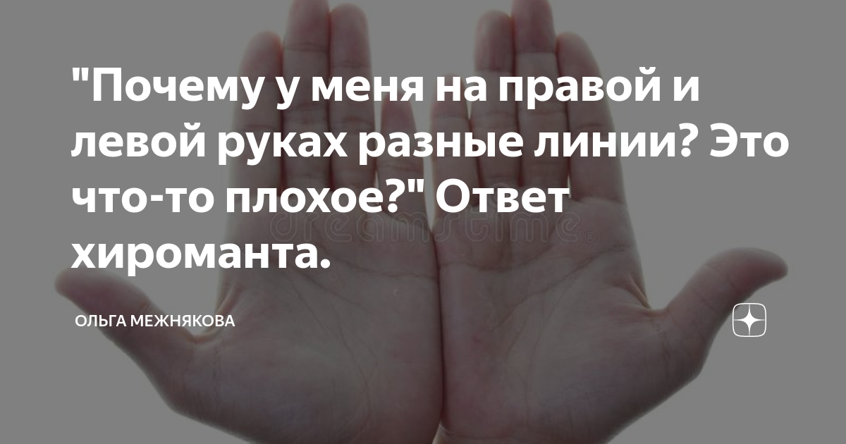 "Почему у меня на правой и левой руках разные линии? Это что-то плохое ...