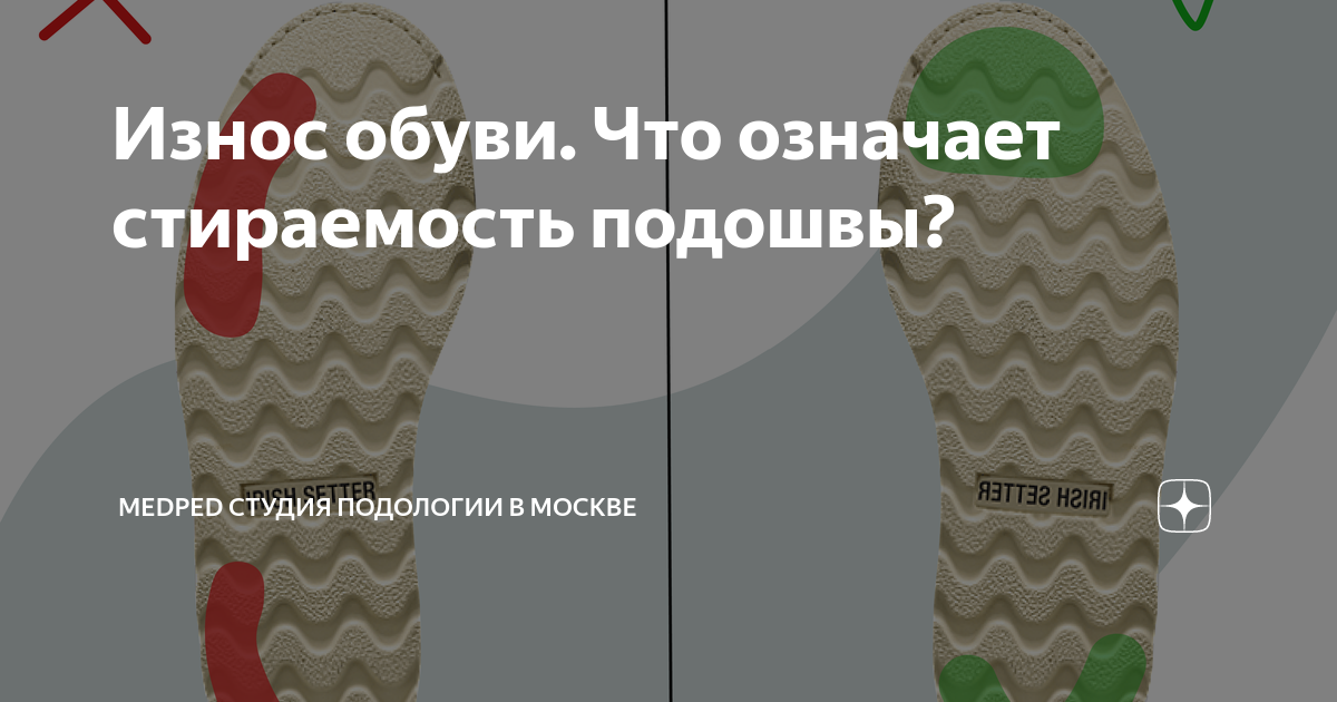Износ обуви. Что означает стираемость подошвы? | Medped.ru | Дзен