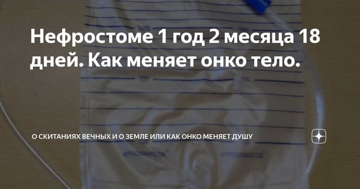 Нефростоме 1 год 2 месяца 18 дней. Как меняет онко тело. | О скитаниях ...