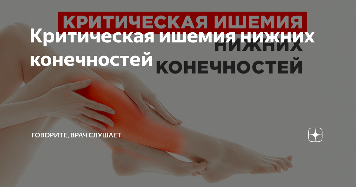 Критическая ишемия нижних конечностей Первый клинический медицинский