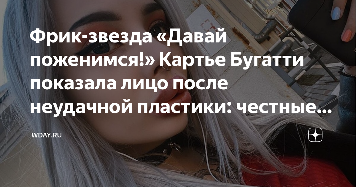 Фрик-звезда «Давай поженимся!» Картье Бугатти показала лицо после неудачной пластики: честные ...