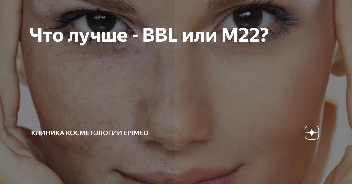 Что лучше - BBL или M22? | Клиника косметологии Epimed | Дзен