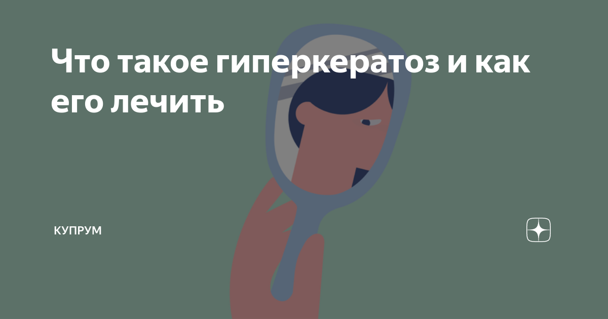 Что такое гиперкератоз и как его лечить | Купрум | Дзен