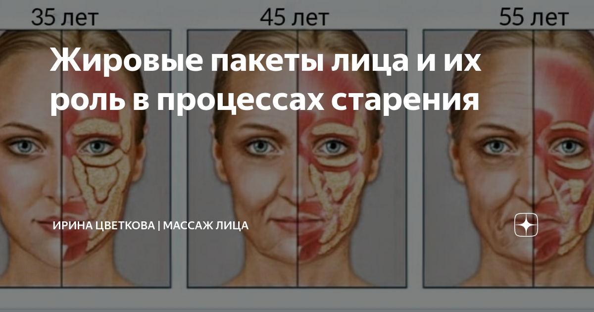 Жировые пакеты лица и их роль в процессах старения Ирина Цветкова