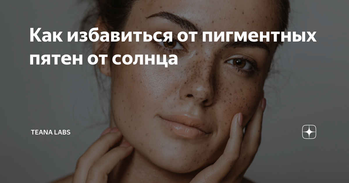 Как избавиться от пигментных пятен от солнца | Teana Labs | Дзен