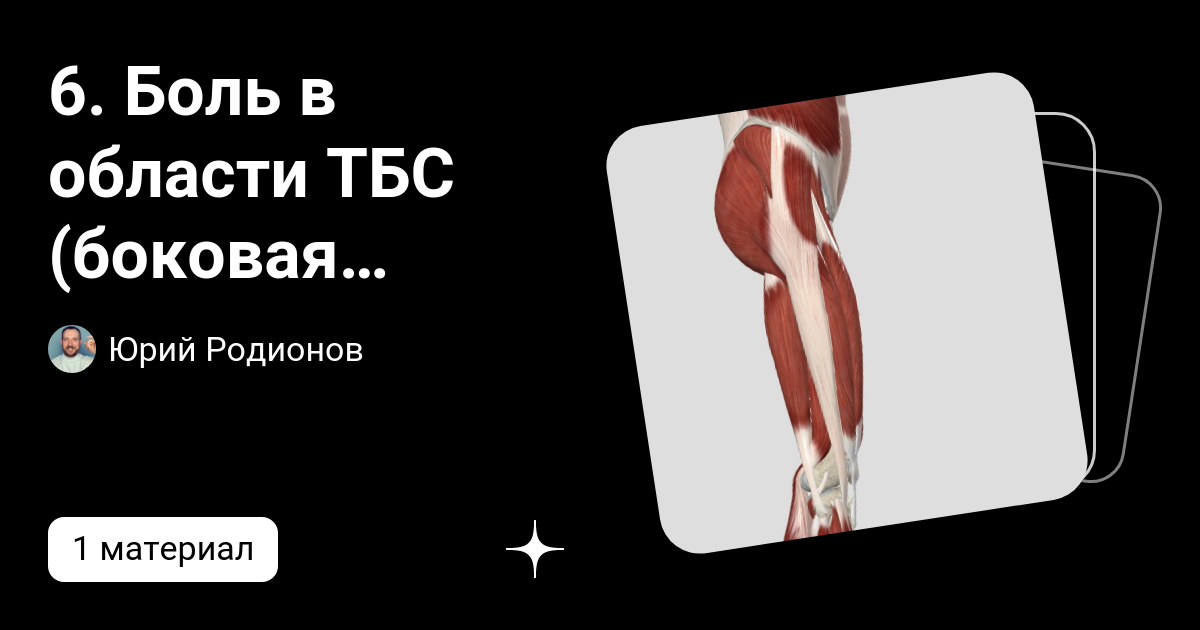6. Боль в области ТБС (боковая поверхность таза), бедре и колене | Юрий ...