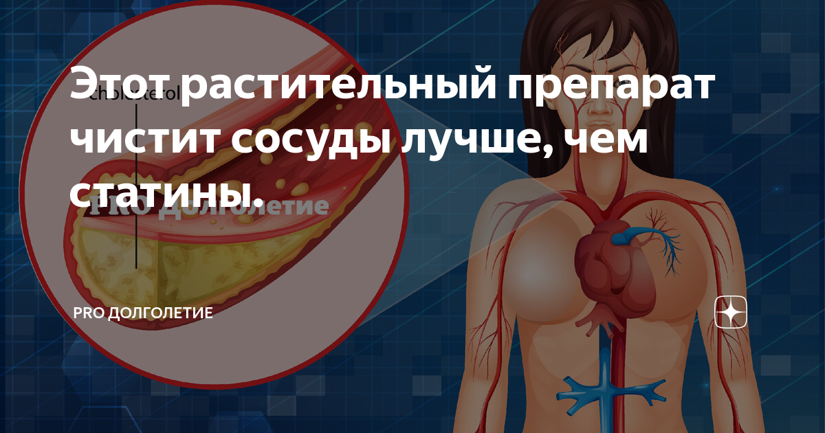 Этот растительный препарат чистит сосуды лучше, чем статины. | PRO ...