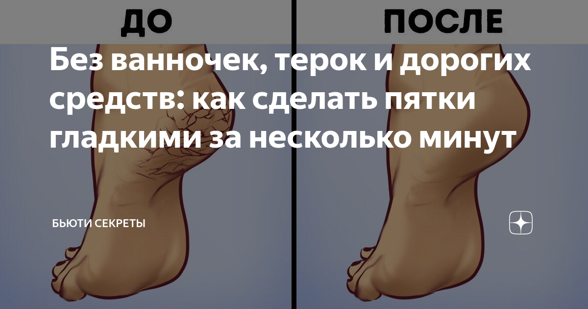 Без ванночек, терок и дорогих средств: как сделать пятки гладкими за ...