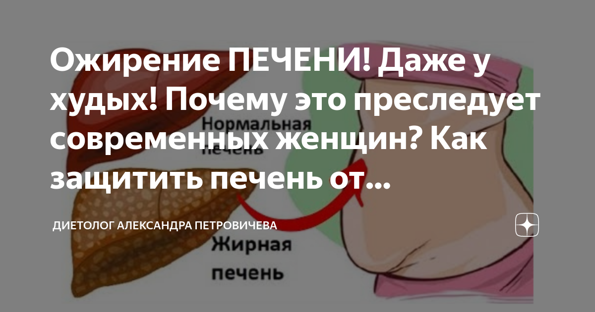 Ожирение ПЕЧЕНИ Даже у худых Почему это преследует современных женщин