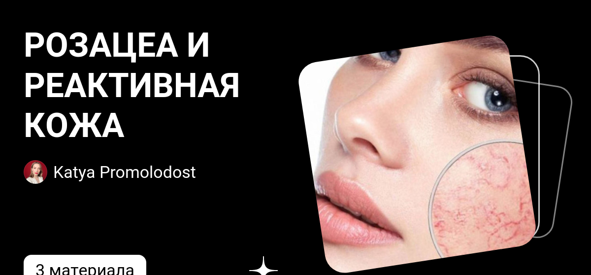 РОЗАЦЕА И РЕАКТИВНАЯ КОЖА | Katya Promolodost | Дзен